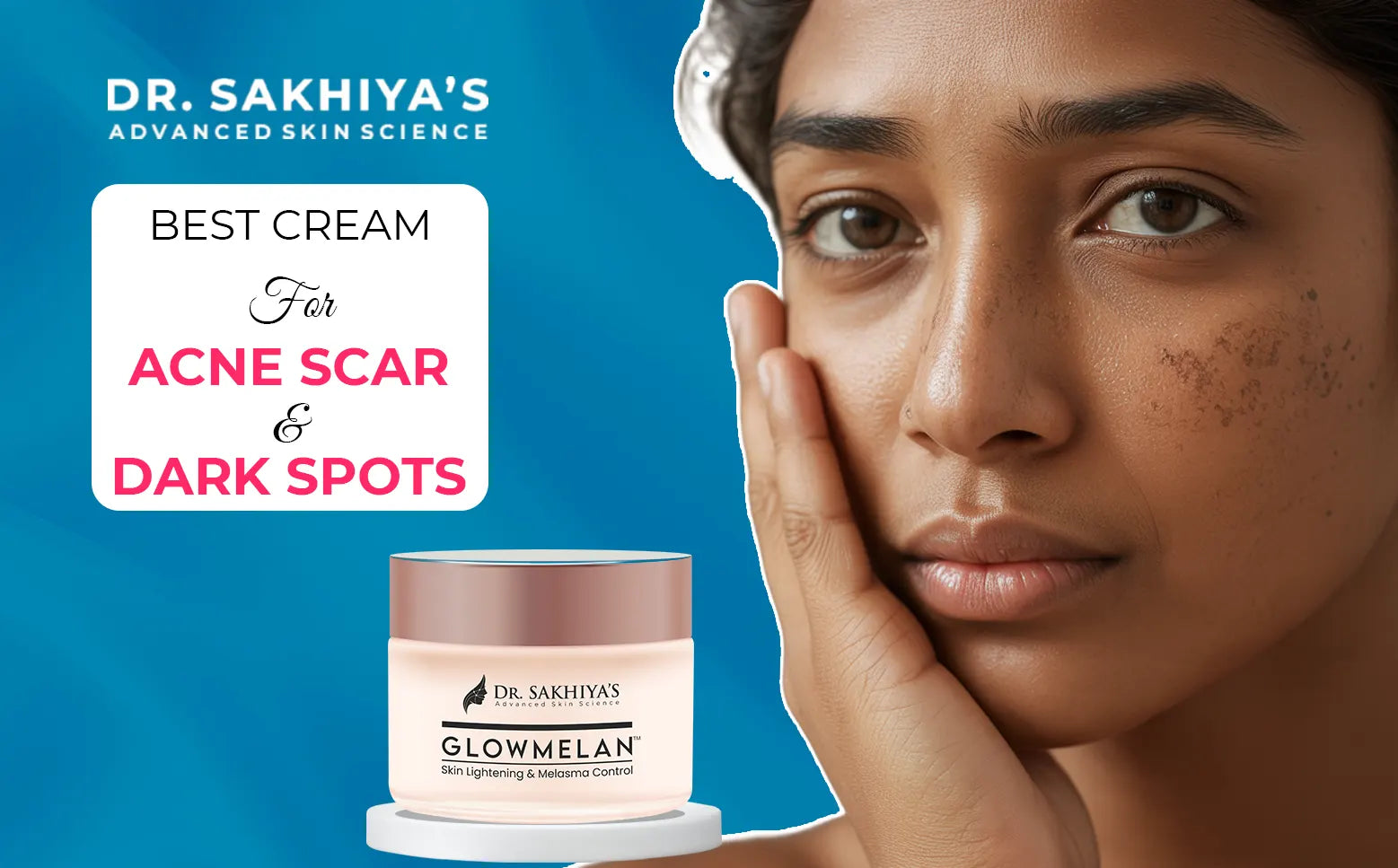 Best Cream for Acne Scars and Dark Spots – Dr. Sakhiya's – Advanced ...