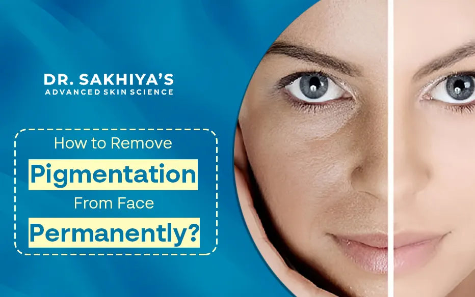How to Remove Pigmentation From Face Permanently? – Dr. Sakhiya's ...